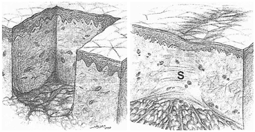 Nonregenerative Tissues | Basicmedical Key