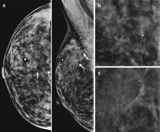 Overview of Radiologic Quality Assurance and the Imaging Evaluation of ...