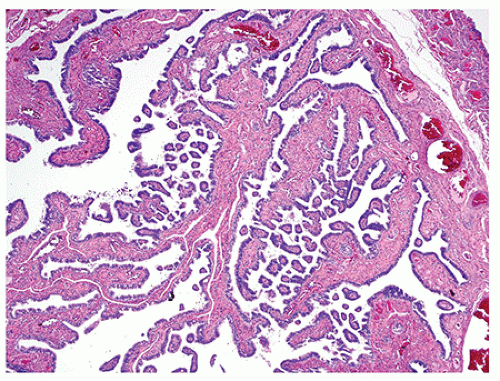 Fallopian Tube and Paratubal Region | Basicmedical Key