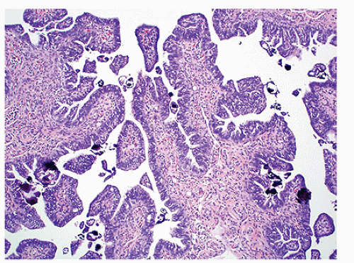 Fallopian Tube and Paratubal Region | Basicmedical Key