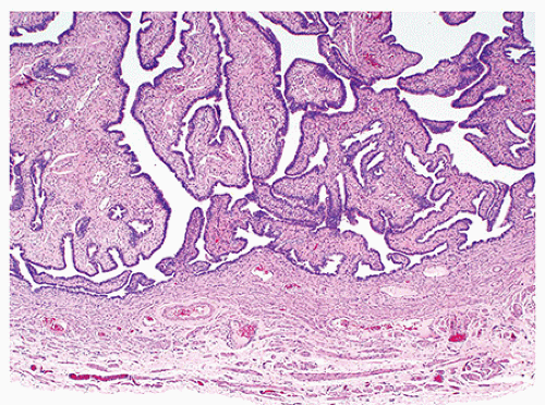 Fallopian Tube and Paratubal Region | Basicmedical Key