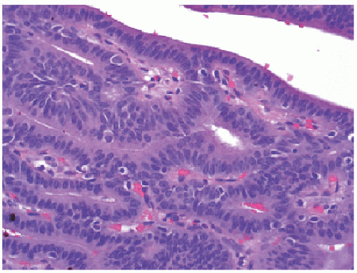 Thyroid and Parathyroid Glands | Basicmedical Key
