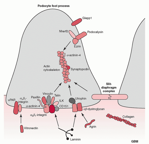 Proteinuria and Nephrotic Syndrome | Basicmedical Key