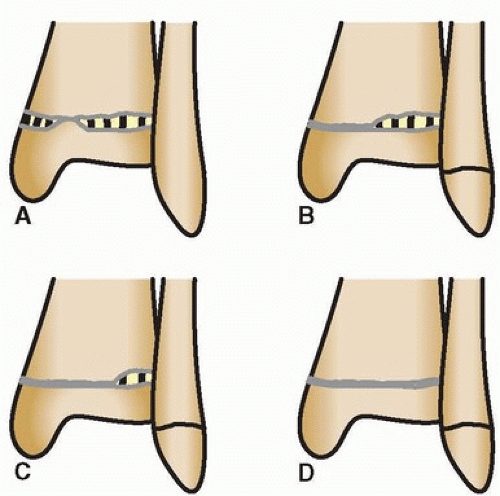 Ankle | Basicmedical Key