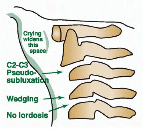 Spine | Basicmedical Key