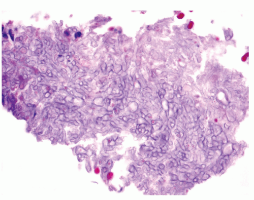 Nonneoplastic Lesions of the Nasal Cavity, Paranasal Sinuses, and ...