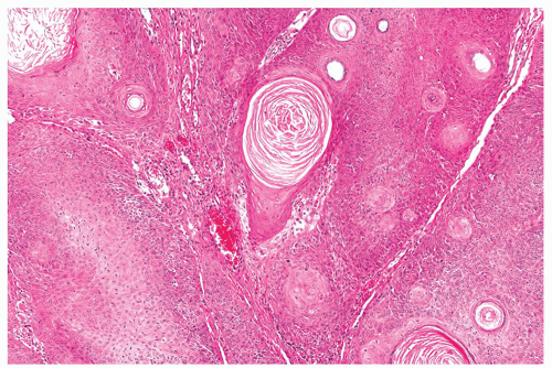 Pathology of the Ear | Basicmedical Key