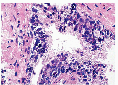 Prostate | Basicmedical Key
