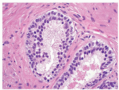 Prostate | Basicmedical Key