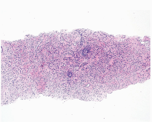 Prostate | Basicmedical Key