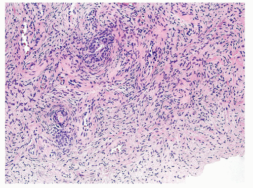 Prostate | Basicmedical Key