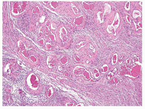 Prostate | Basicmedical Key