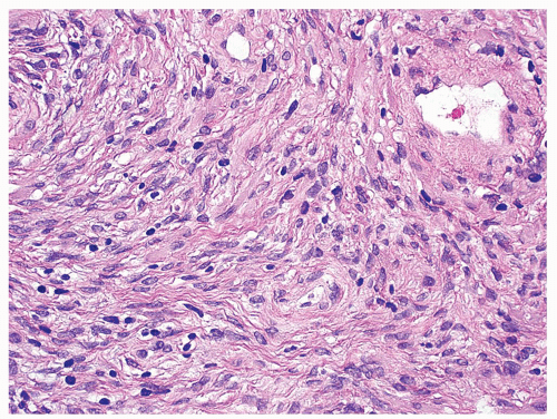 Prostate | Basicmedical Key