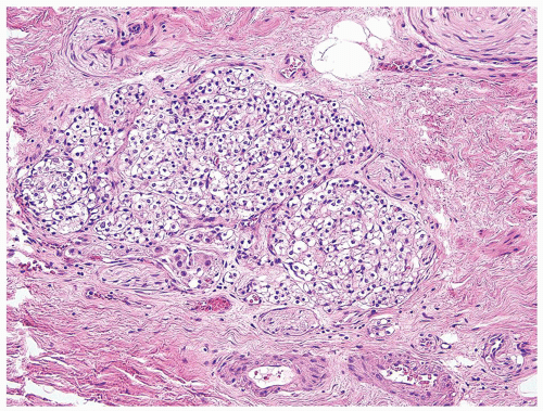 Prostate | Basicmedical Key