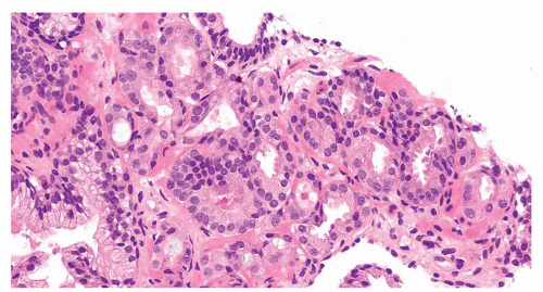 Prostate | Basicmedical Key