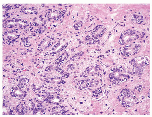 Prostate | Basicmedical Key