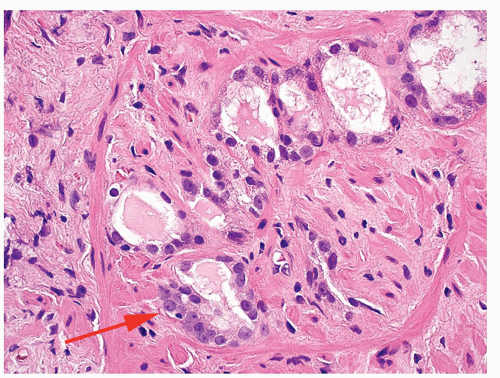 Prostate | Basicmedical Key