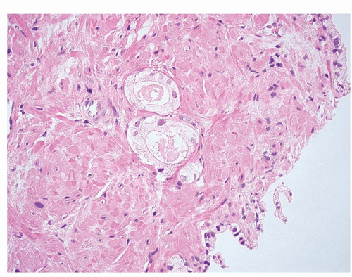 Prostate | Basicmedical Key