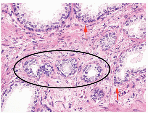 Prostate | Basicmedical Key