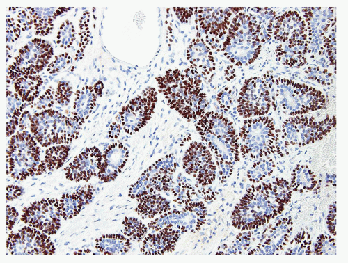 Prostate | Basicmedical Key