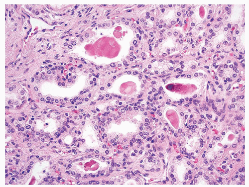 Prostate | Basicmedical Key