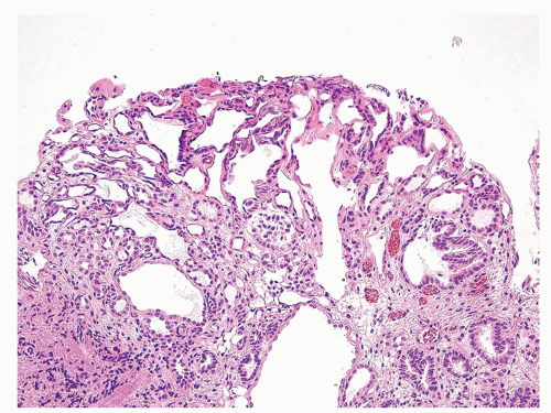 Prostate | Basicmedical Key