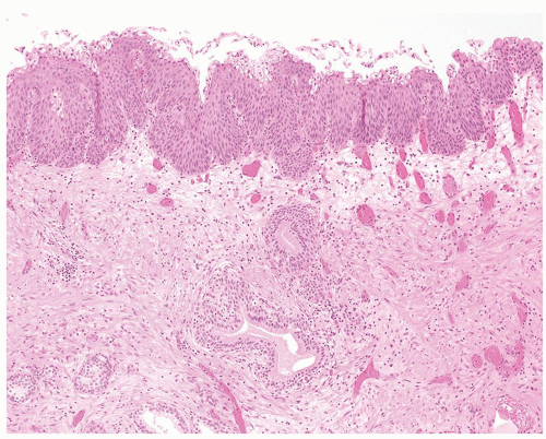Bladder | Basicmedical Key
