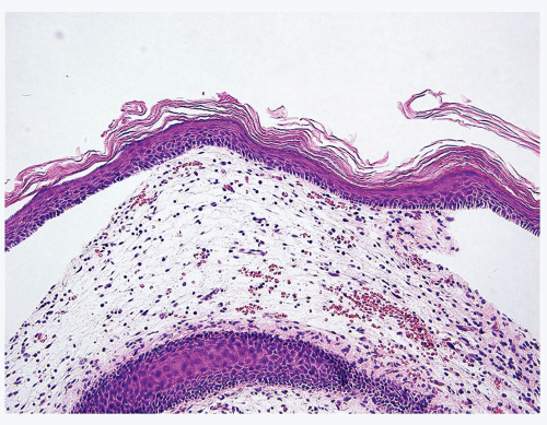 Bladder | Basicmedical Key