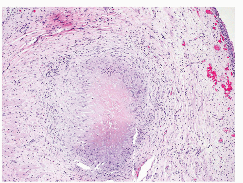 Bladder | Basicmedical Key