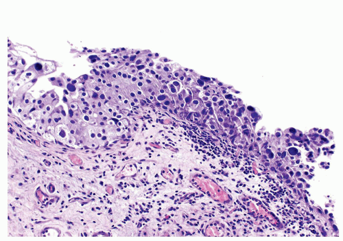 Bladder | Basicmedical Key