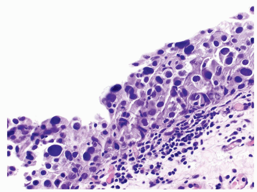 Bladder | Basicmedical Key