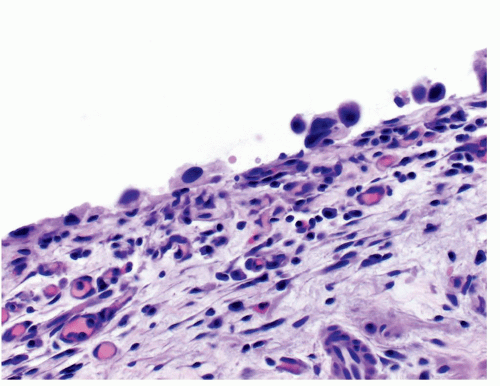 Bladder | Basicmedical Key