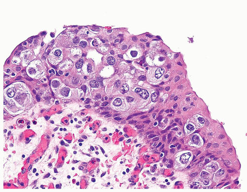 Bladder | Basicmedical Key