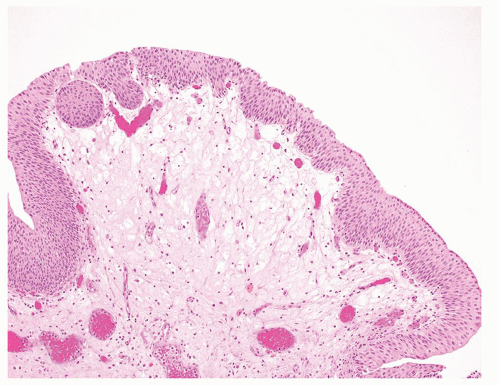 Bladder | Basicmedical Key