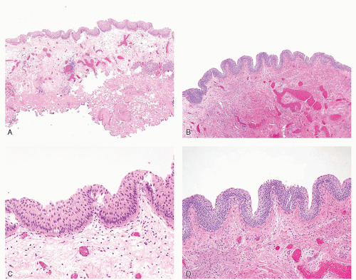 Bladder | Basicmedical Key