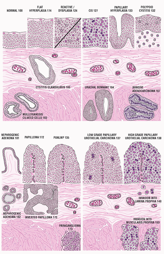 Bladder | Basicmedical Key
