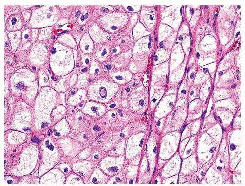 Kidney | Basicmedical Key