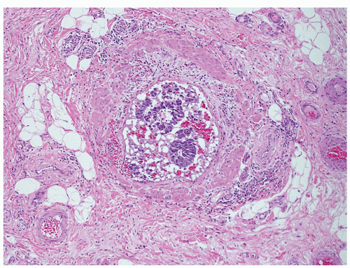 Testis | Basicmedical Key