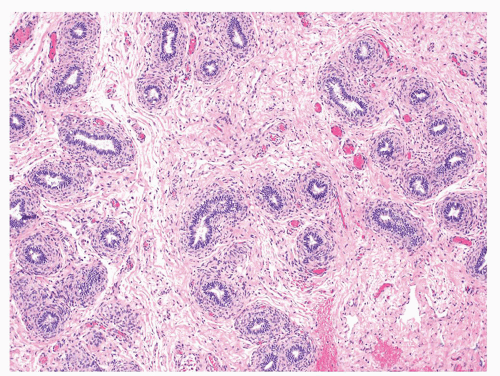 Testis | Basicmedical Key