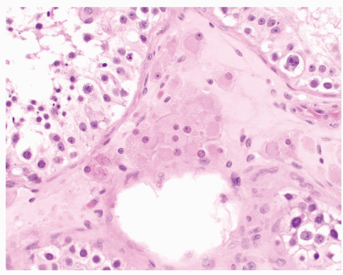 Testis | Basicmedical Key