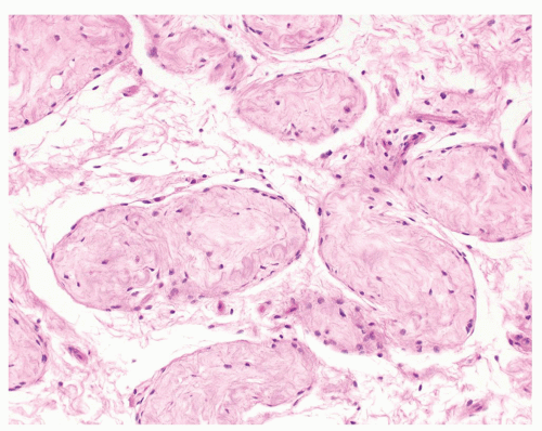 Testis | Basicmedical Key