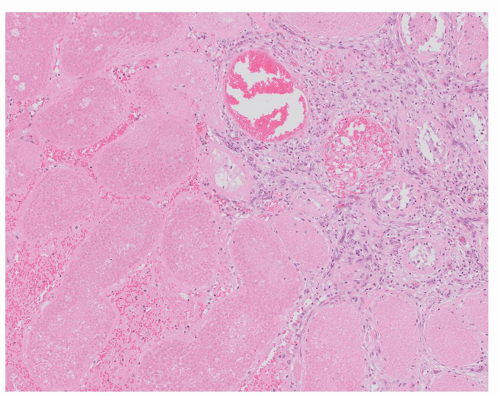 Testis | Basicmedical Key