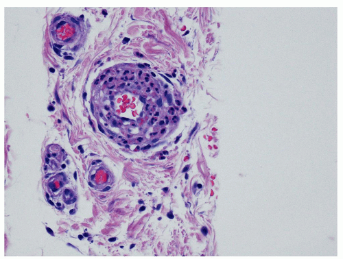 Testis | Basicmedical Key