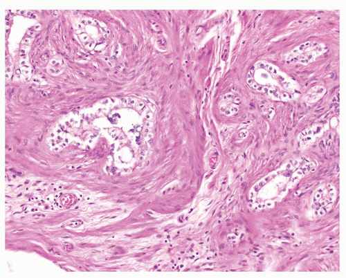 Paratestis and External Genitalia | Basicmedical Key