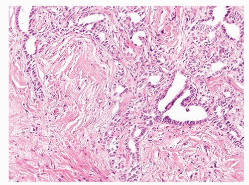 Paratestis and External Genitalia | Basicmedical Key