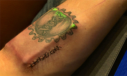 ‘Biohacker’ Implants Chip in Arm – BIOENGINEER.ORG