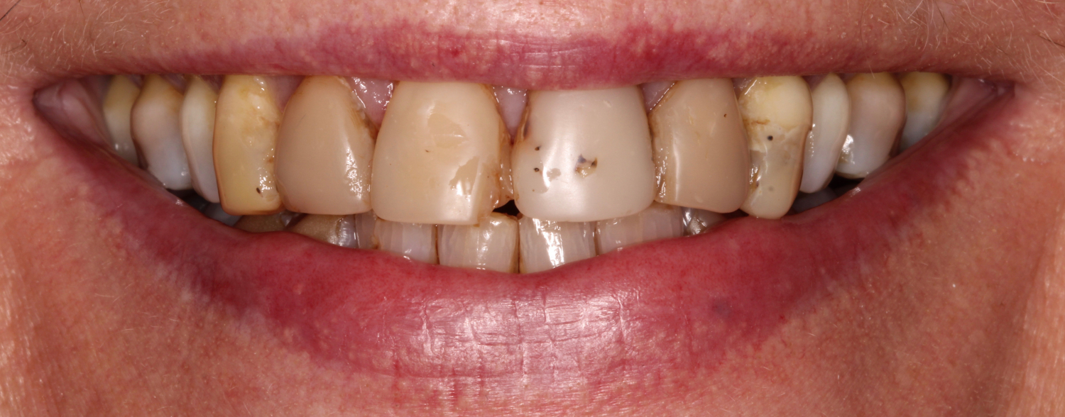 Dentist Kingston PA - Your Local Dental Office | Brand Dental