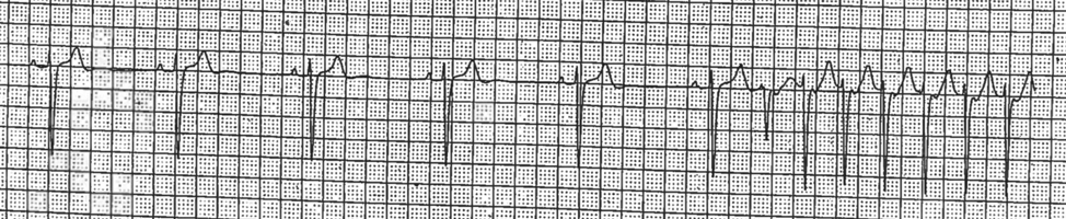 Tele Strip #1 – The Clinical Problem Solvers