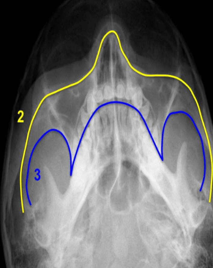 Facial bone x-rays – Don't Forget the Bubbles