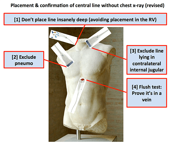 Doubling down: ultrasound confirms central line position - EMCrit Project